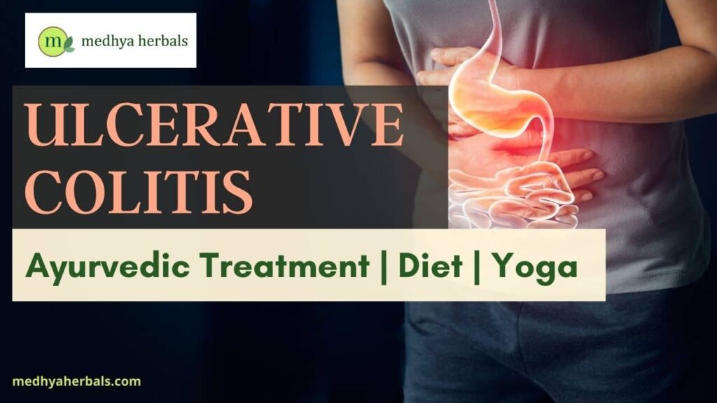 Ulcerative Colitis Ayurvedic Treatment | 5 Natural Ways to Heal Your Gut