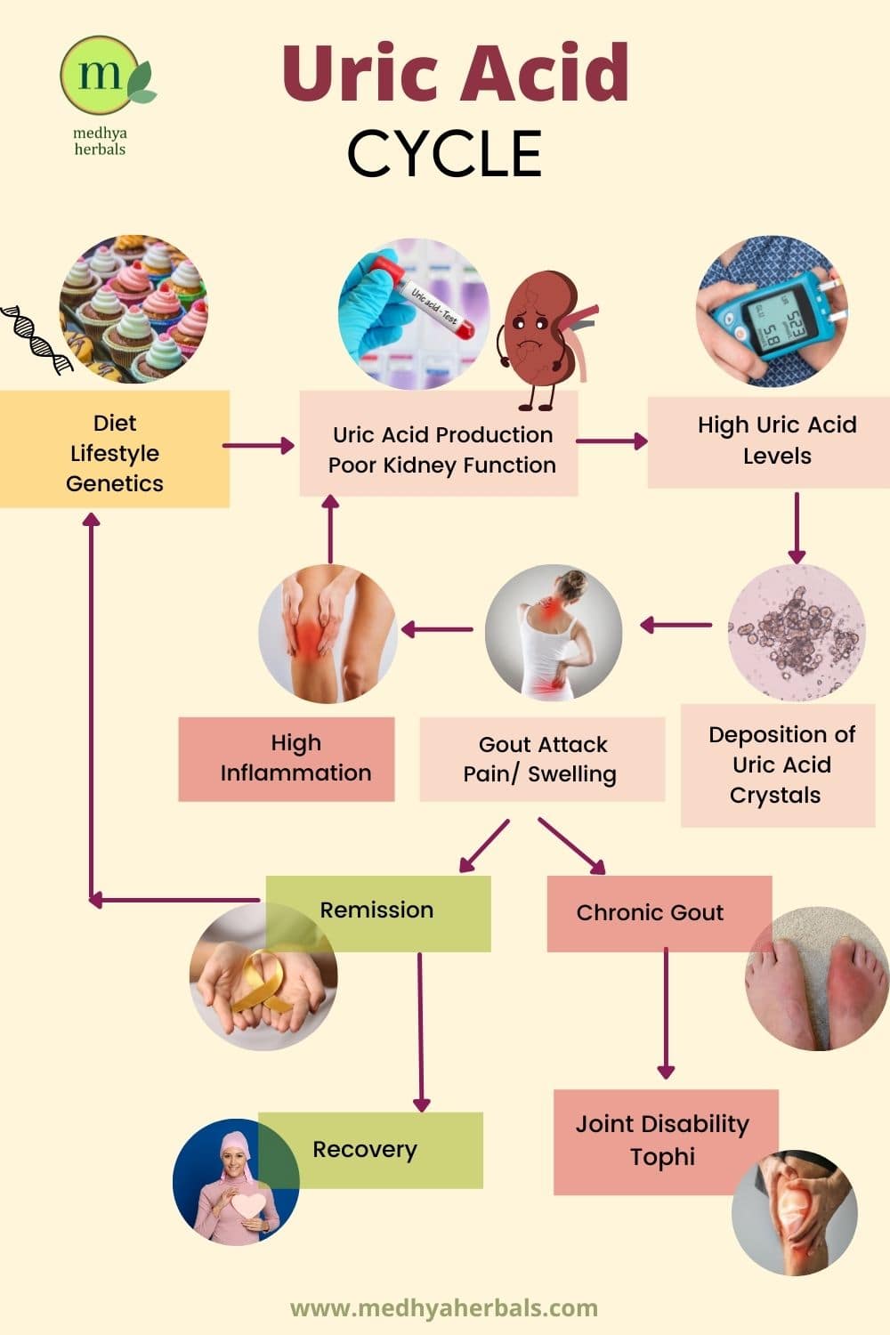 Gout, High Uric Acid, Joint Pain | 5 Ayurvedic Ways for Natural Relief