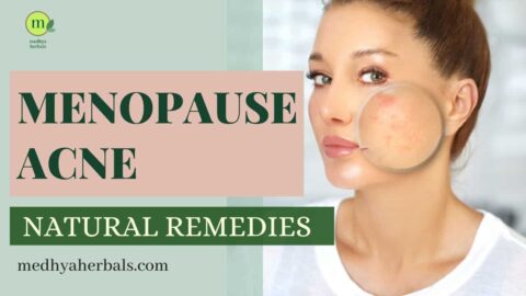 How to Stop Menopause Acne: Natural Remedies That Work!