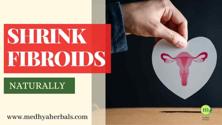 9 Powerful Ways to Shrink Fibroids Naturally